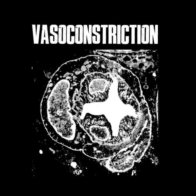 Mar 23, 2018: Psilocybe / Vasoconstriction / Corot / Skin Pop at The ...