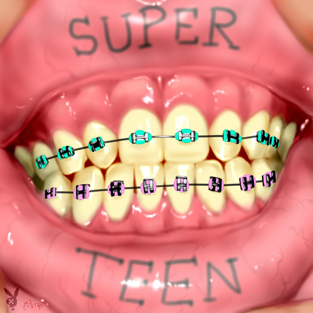 Superteen - song and lyrics by Novocain | Spotify