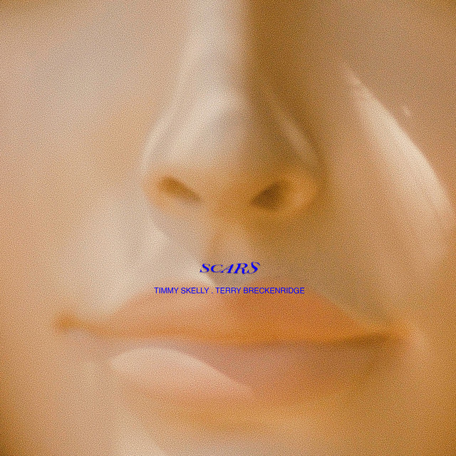 Scars - Single by Timmy Skelly | Spotify