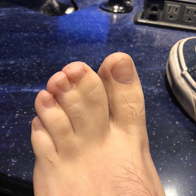 DELICIOUS TOES - Single by Young McNugget | Spotify