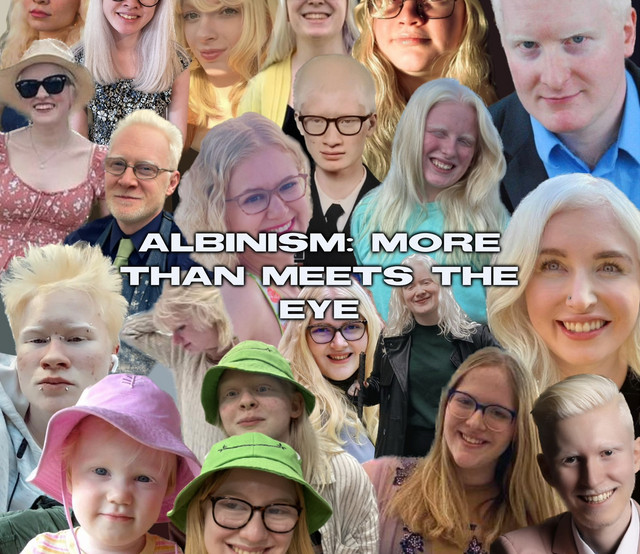 Albinism: More Than Meets the Eye | Podcast on Spotify
