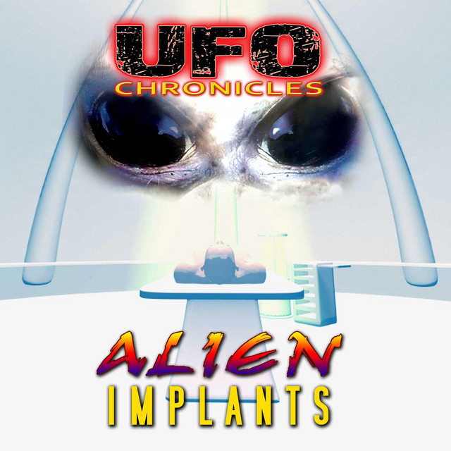UFO Chronicles: Alien Implants | Audiobook on Spotify