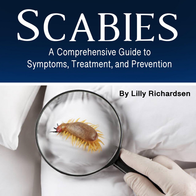 Scabies: A Comprehensive Guide to Symptoms, Treatment, and Prevention ...