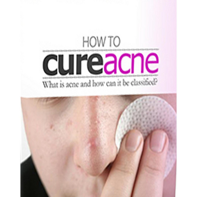 How To Cure Acne: What is acne and how can it be classified ...