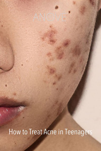 acne - playlist by mookid | Spotify